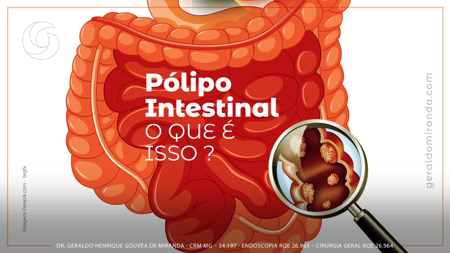 Pólipo intestinal: o que é isso? – Blog Dr. Geraldo Henrique Gouvêa de ...